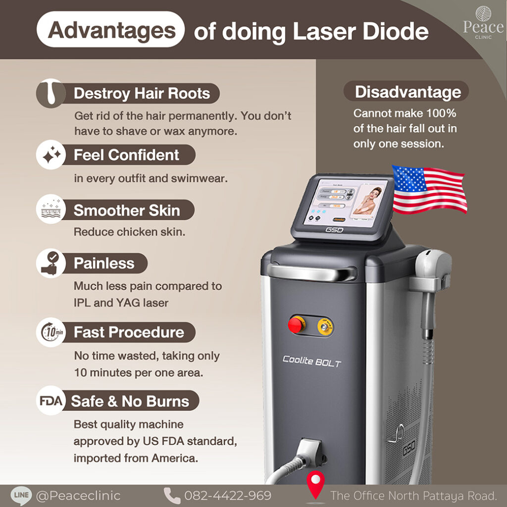 Painless Hair Removal with Laser Diode - Peace Clinic