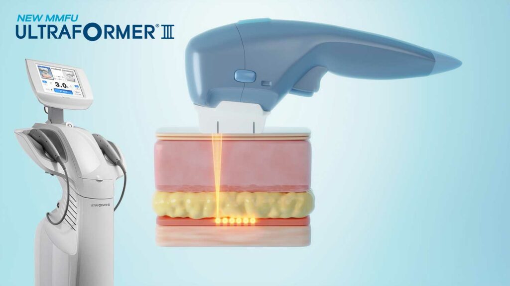 Ultraformer III - Peace Clinic